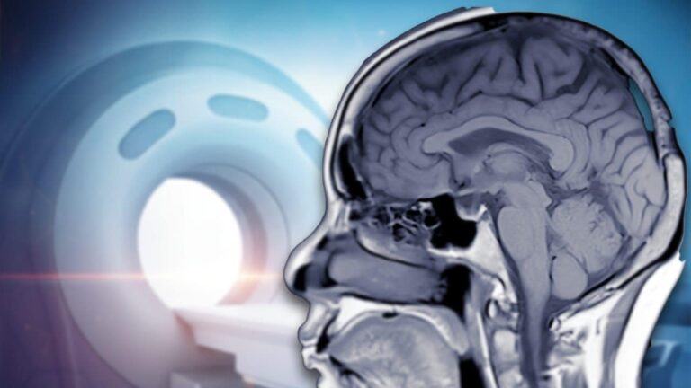 The science of magnetic resonance imaging: how the machine works to ...